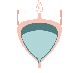 How is Interstitial Cystitis Diagnosed? – TREATING INTERSTITIAL CYSTITIS